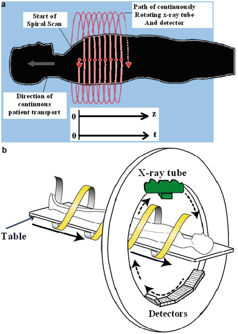 Computed Tomography | SpringerLink