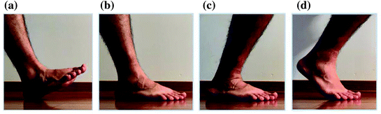 A Novel Foot Progression Angle Detection Method | SpringerLink