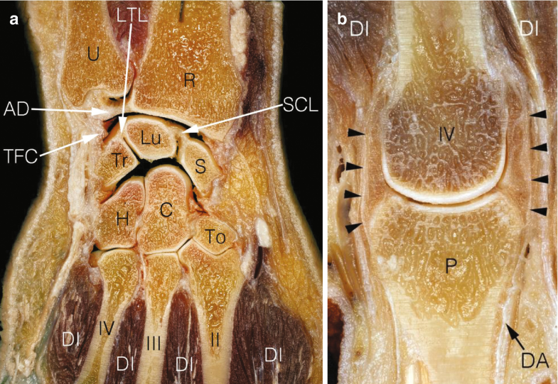 Gross Anatomy of the Human Hand | SpringerLink