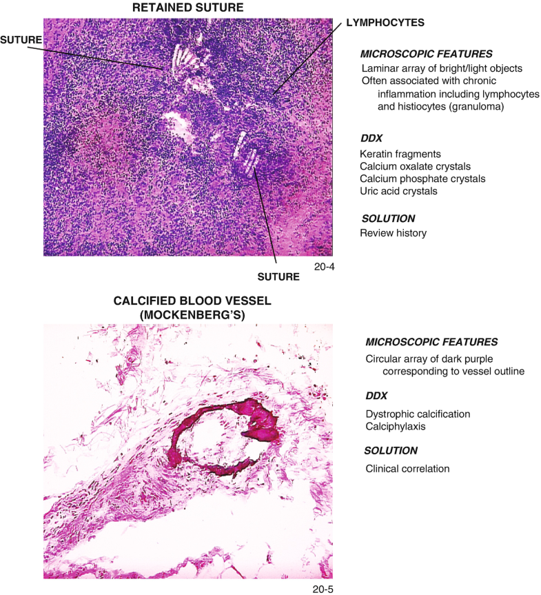 Histotechnique and Staining Troubleshooting | SpringerLink