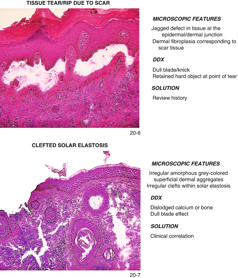 Histotechnique and Staining Troubleshooting | SpringerLink