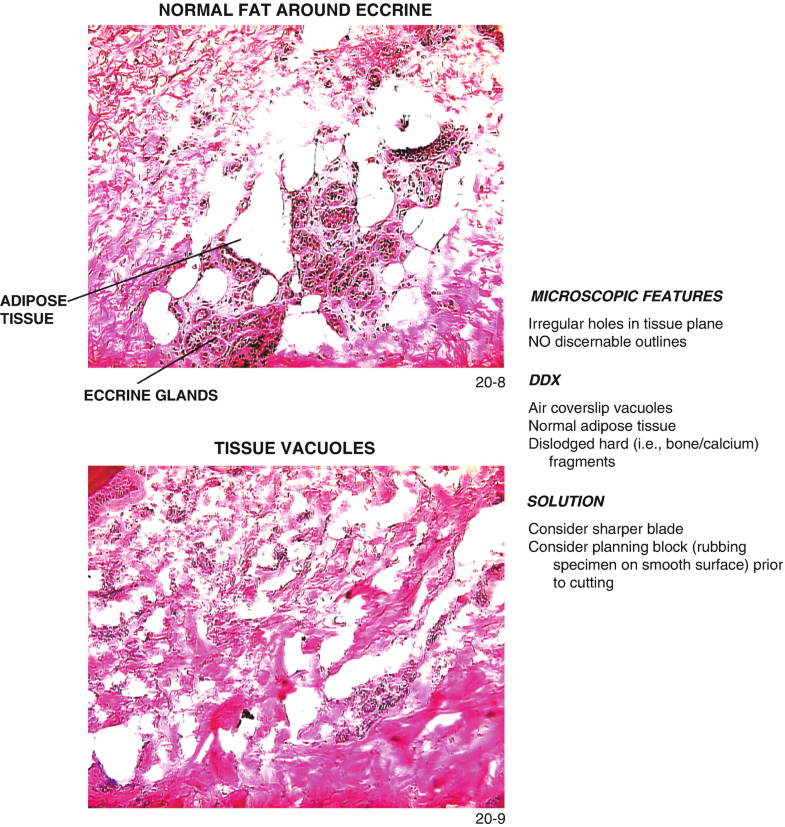 Histotechnique and Staining Troubleshooting | SpringerLink