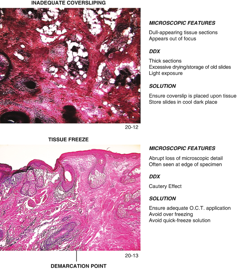 Histotechnique and Staining Troubleshooting | SpringerLink