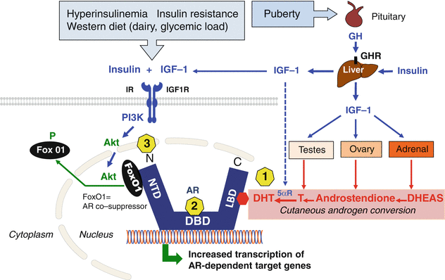 Acne and Genetics | SpringerLink