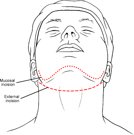Oral Cavity and Oropharynx | SpringerLink