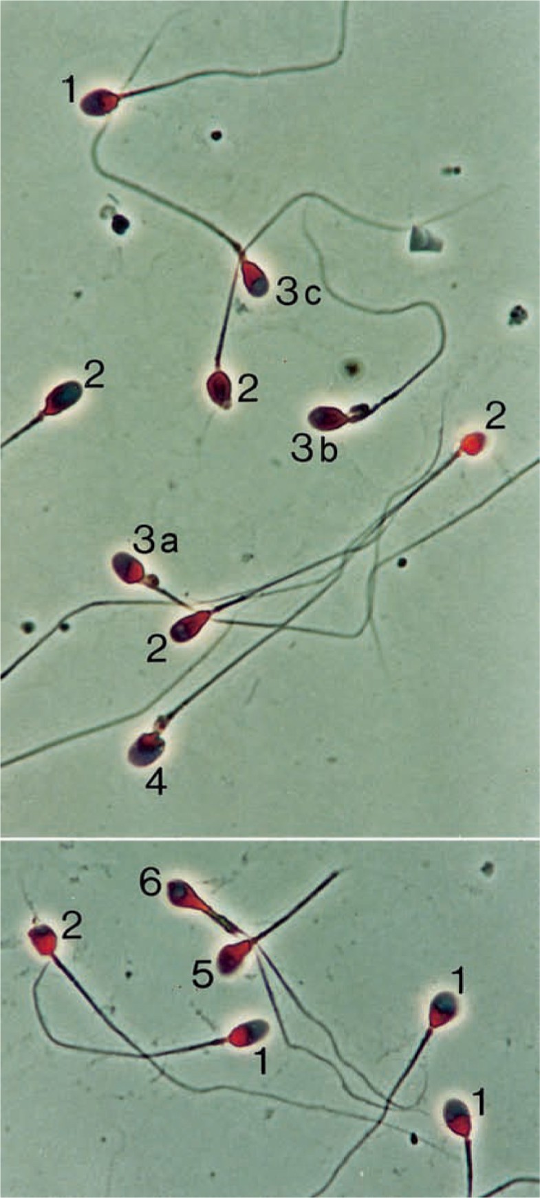 Semen Analysis | SpringerLink