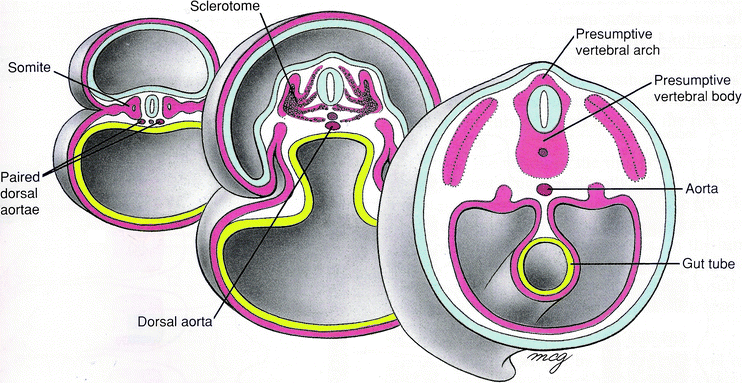 Embryology and Anatomy: Spine/Spinal Cord | SpringerLink
