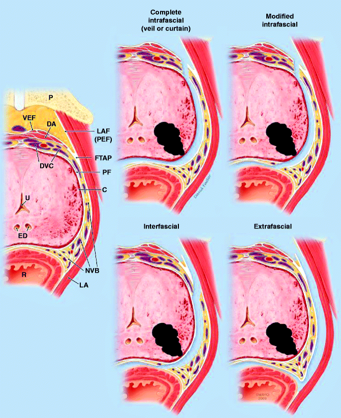 Anatomy: Anatomic Considerations for Efficiency and Precision in ...