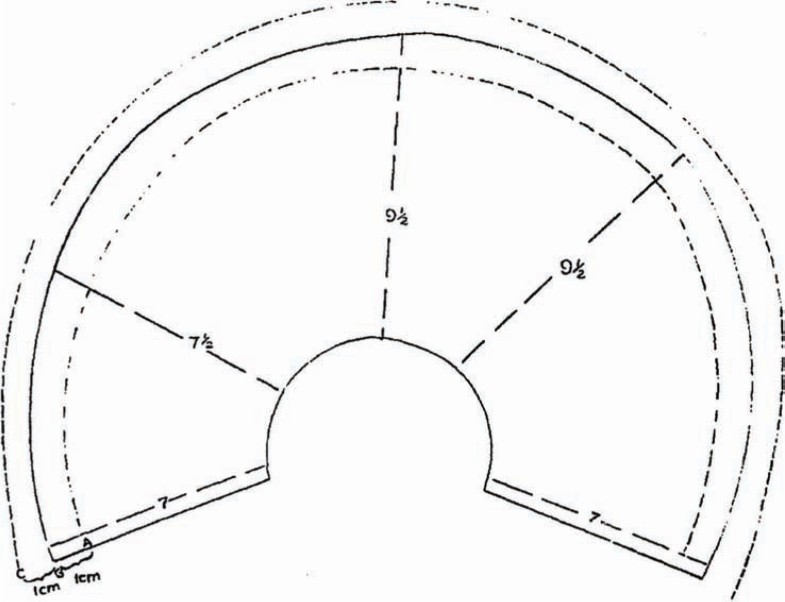History of Breast Reduction | SpringerLink
