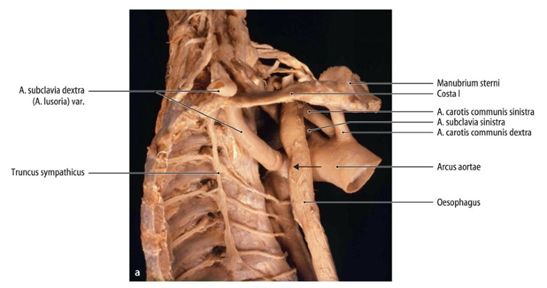 Anatomie der Gefäße und operative Zugangswege | SpringerLink