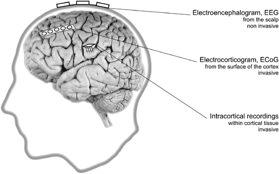 Brain–Computer Interfaces: A Gentle Introduction | SpringerLink