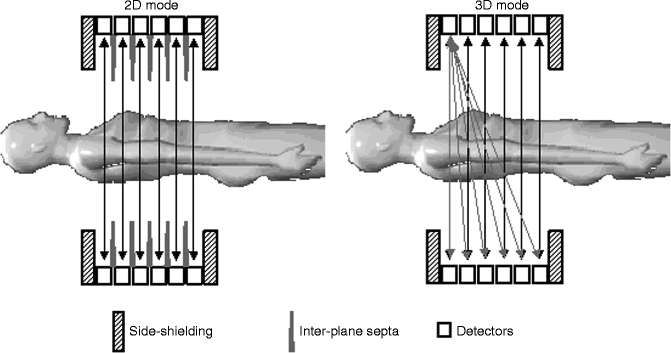 Basic Principles of SPECT and PET Imaging | SpringerLink