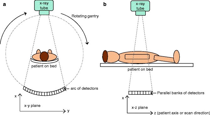 Basics of CT | SpringerLink