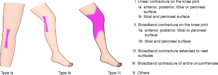 Diagnosis, Assessment, and Classification of Scar Contractures ...