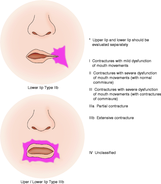 Diagnosis, Assessment, and Classification of Scar Contractures ...