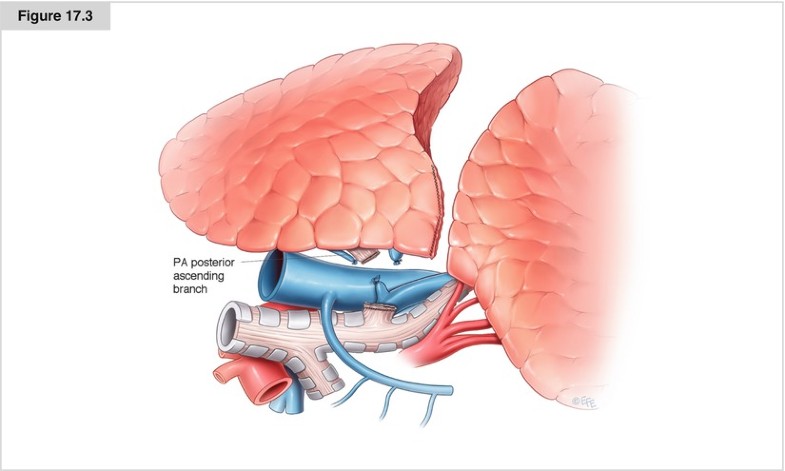 Pulmonary Lobectomy (Thoracotomy and VATS) | SpringerLink