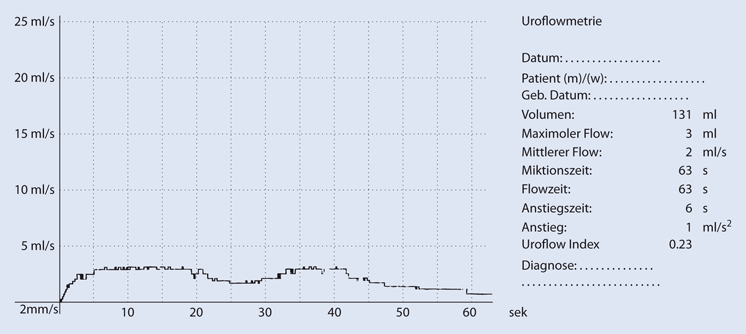 Uroflowmetrie | SpringerLink