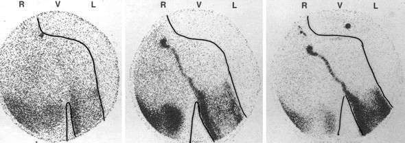 Lymphgefäßerkrankungen | SpringerLink