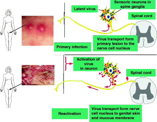 Biology of Sexually Transmitted Herpes Viruses | SpringerLink