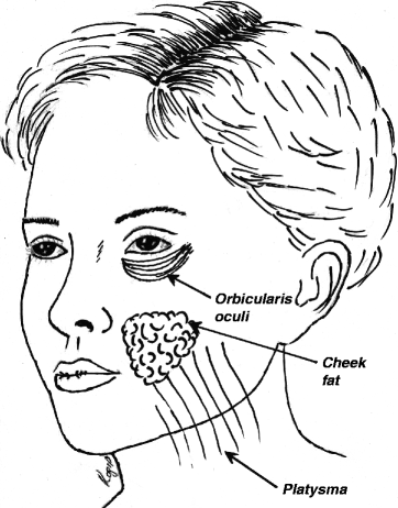 Anatomicohistologic Study of the Retaining Ligaments of the Face with ...