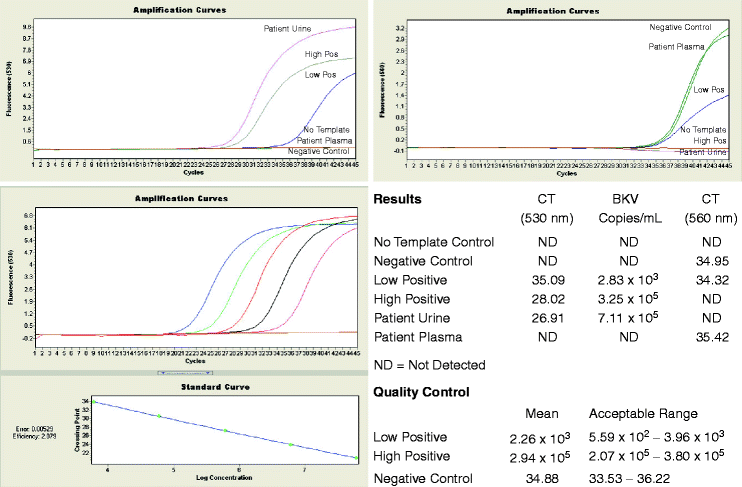 BK Virus | SpringerLink