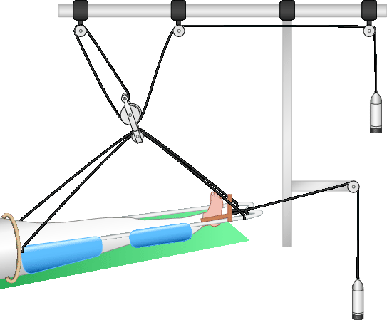 A29 Traction and the Thomas Splint | SpringerLink