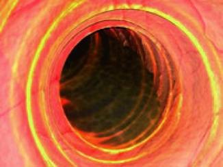 E3 Proctoscopy and Rigid Sigmoidoscopy | SpringerLink