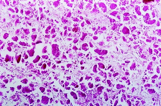 Histothanatology: Autolysis, Putrefaction, Mummification | SpringerLink