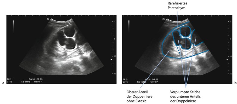 Kinderurologische Krankheitsbilder | SpringerLink