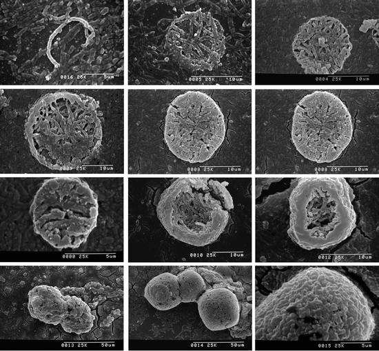 Molecular Basis of Bacterial Calcium Carbonate Precipitation | SpringerLink