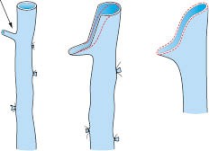 A. femoralis superficialis | SpringerLink
