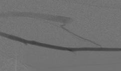 A. femoralis superficialis | SpringerLink