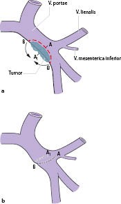 Pfortadersystem | SpringerLink