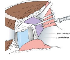Pfortadersystem | SpringerLink
