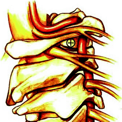 C1–C2 (Harms) Technique | SpringerLink