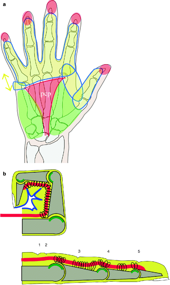 Palmar Fibromatosis or the Loss of Flexibility of the Palmar Finger ...