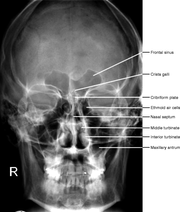 Skull and Jaw | SpringerLink