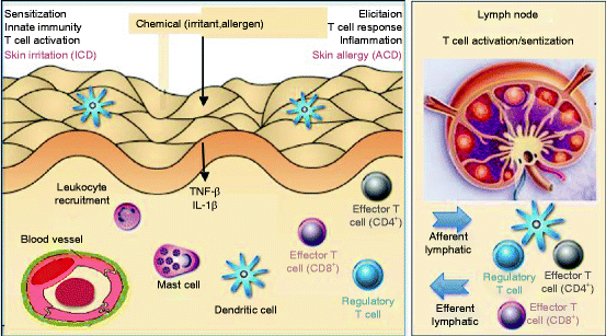 Pathophysiology of Allergic and Irritant Contact Dermatitis | SpringerLink