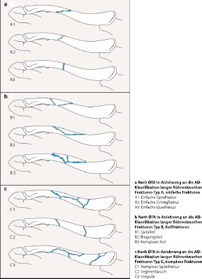 Clavicula | SpringerLink