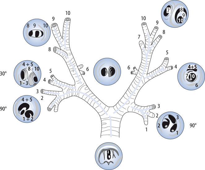 Fiberoptische Bronchoskopie | SpringerLink