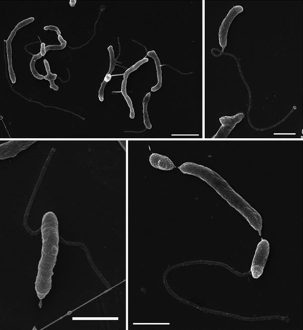 The Family Caulobacteraceae | SpringerLink