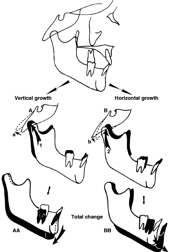 Facial and Palatal Growth | SpringerLink