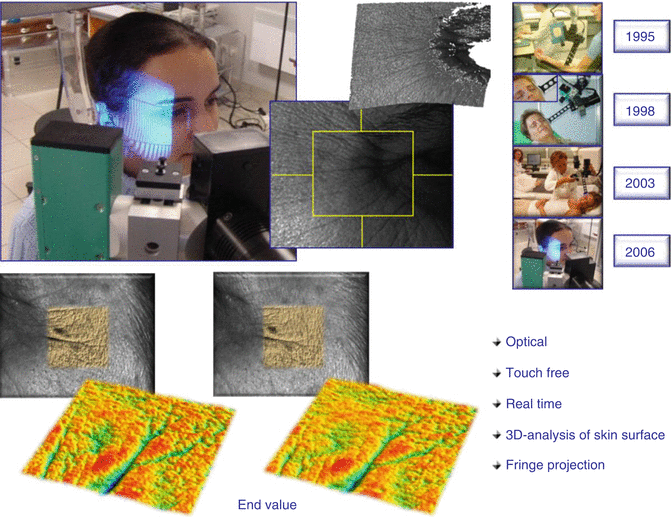 FOITS (Fast Optical In Vivo Topometry of Human Skin) | SpringerLink