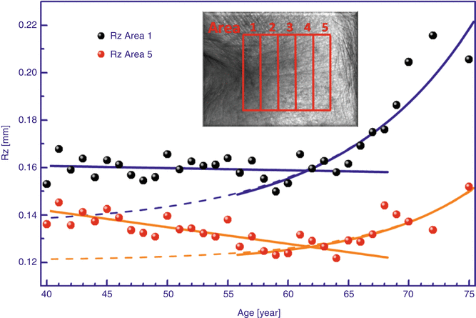 FOITS (Fast Optical In Vivo Topometry of Human Skin) | SpringerLink