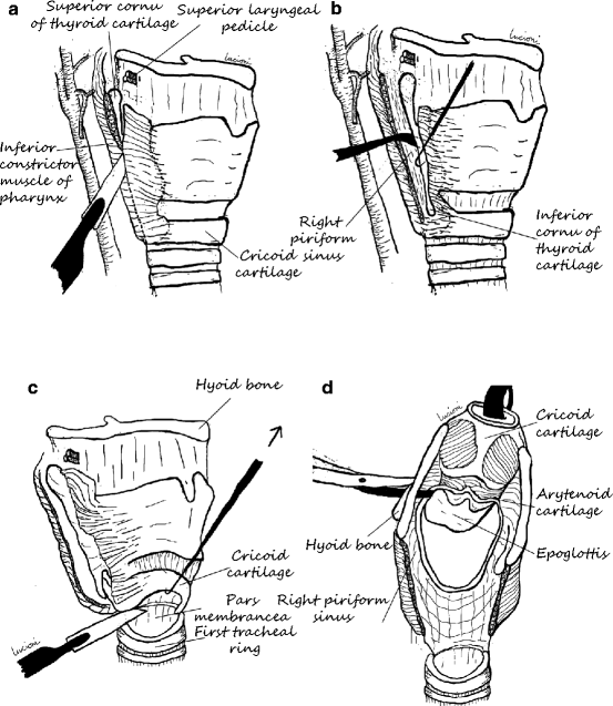 Anterior Region (Robbins Level VI: Superior Part) | SpringerLink