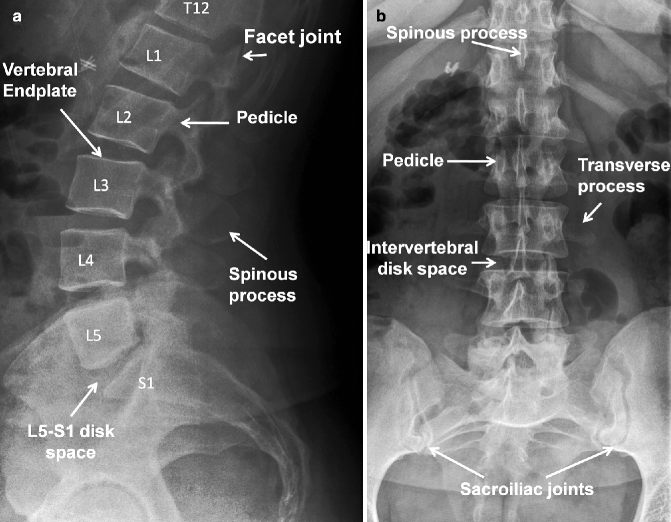 Radiologic Imaging of the Spine | SpringerLink
