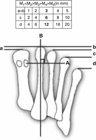 Metatarsalgia | SpringerLink
