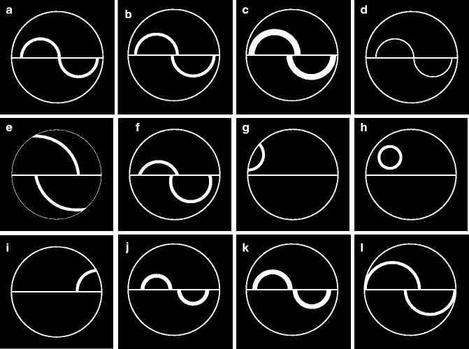 Applanation Tonometry | SpringerLink
