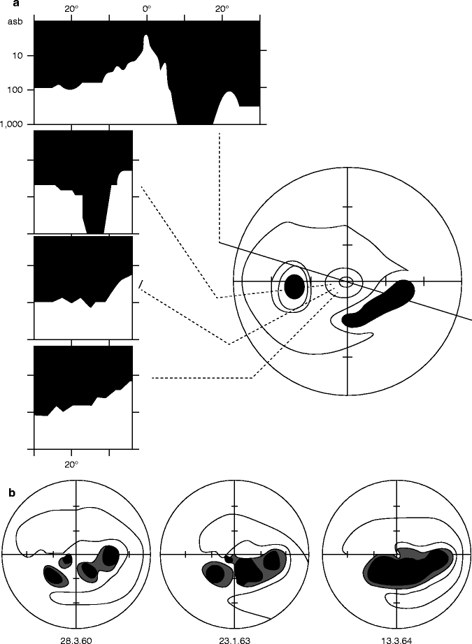 Visual Field Changes in Glaucoma | SpringerLink