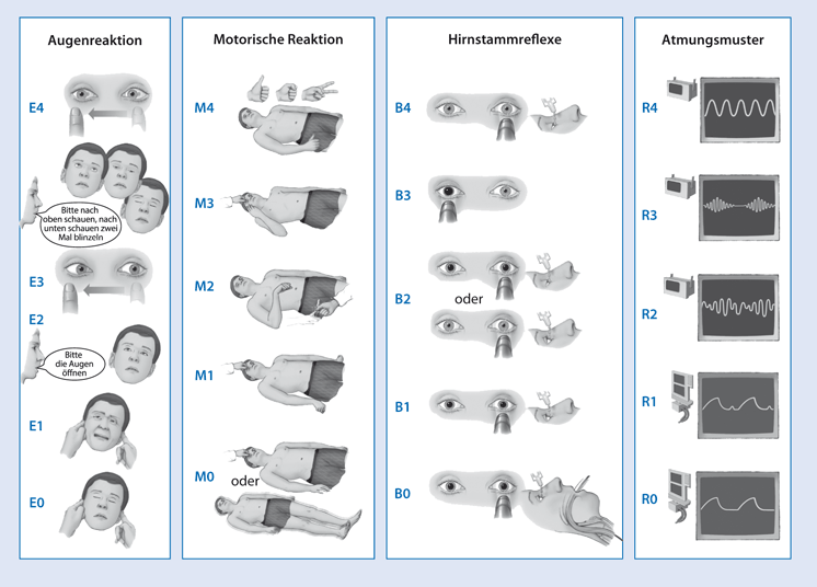 Verlaufsmonitoring von Bewusstseinsstörungen und Enzephalopathien ...